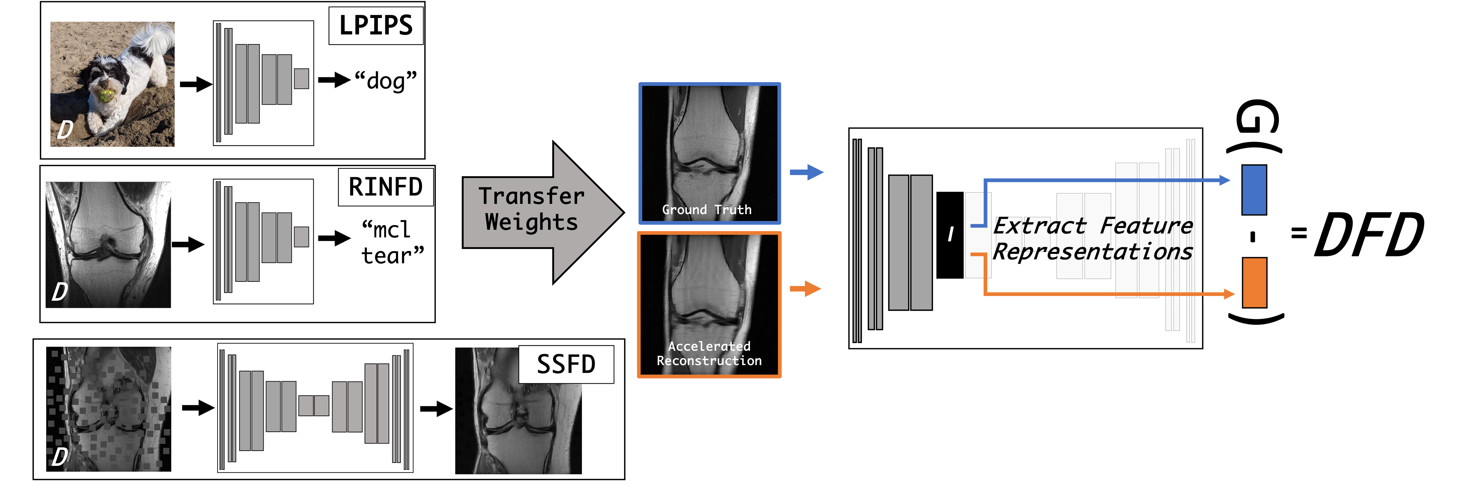 Using Deep Feature Distances for Evaluating MR Image Reconstruction Quality